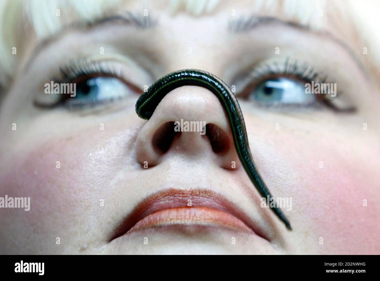Leeches medicine hi-res stock photography and images - Alamy