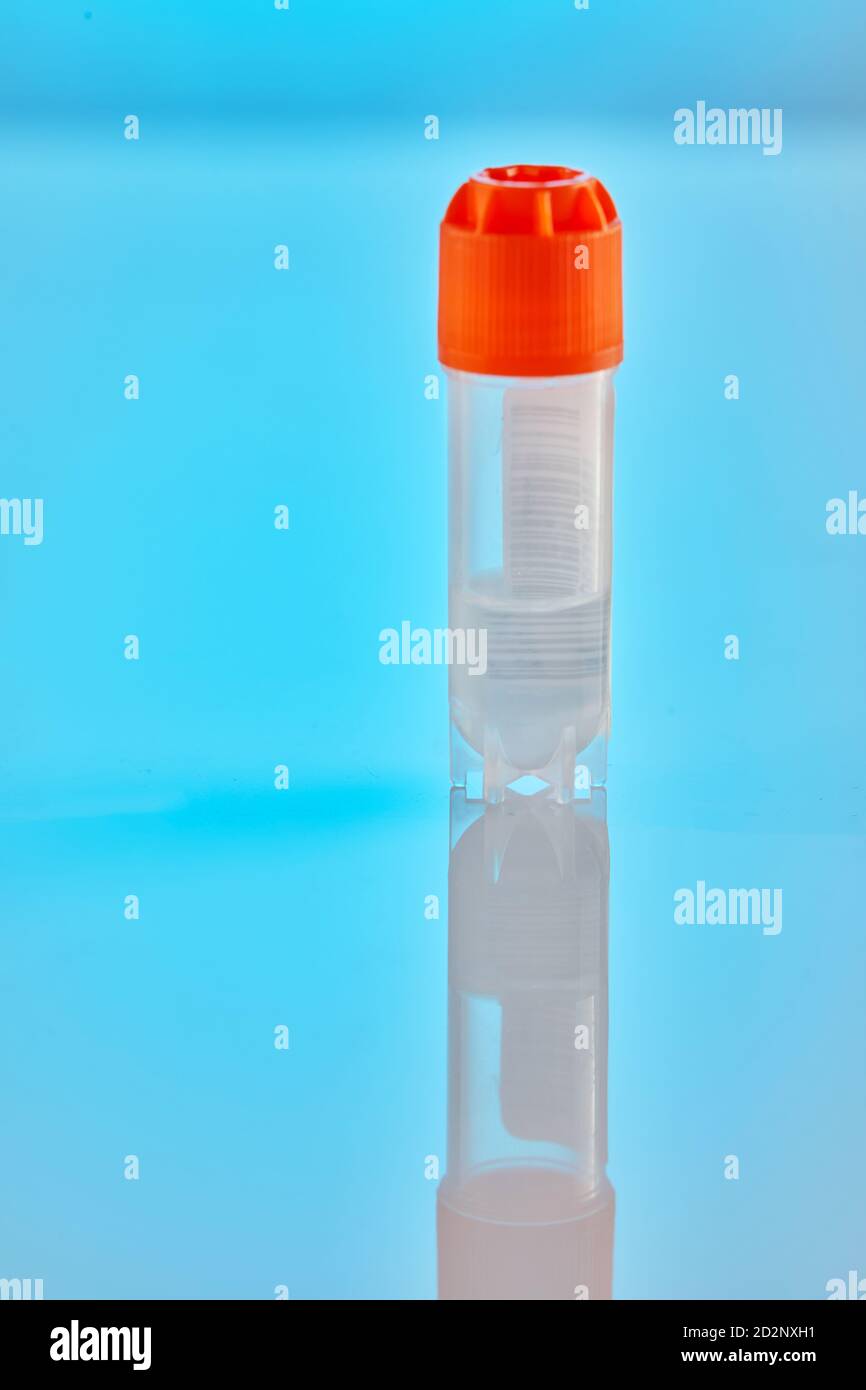 DNA test. Test tube with liquid for DNA analysis on a blue background ...