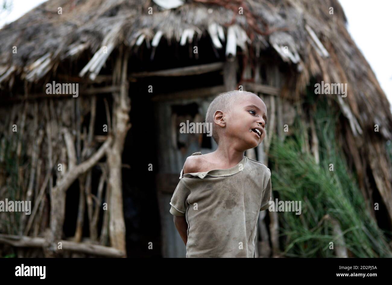 Ethiopia famine 1985 hi-res stock photography and images - Alamy