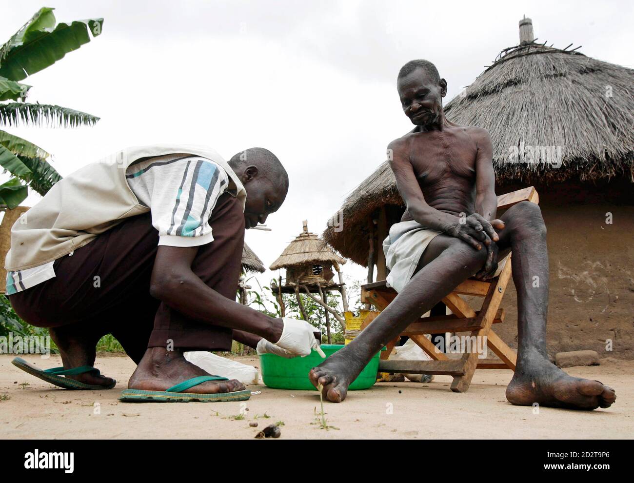 Leprosy medicine hi-res stock photography and images - Alamy