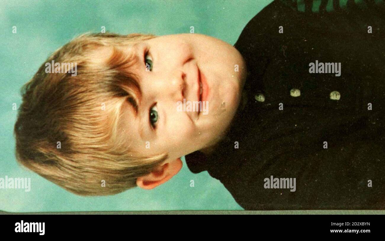 Undated filer of Michael Moore prior to his operation to remove a ...