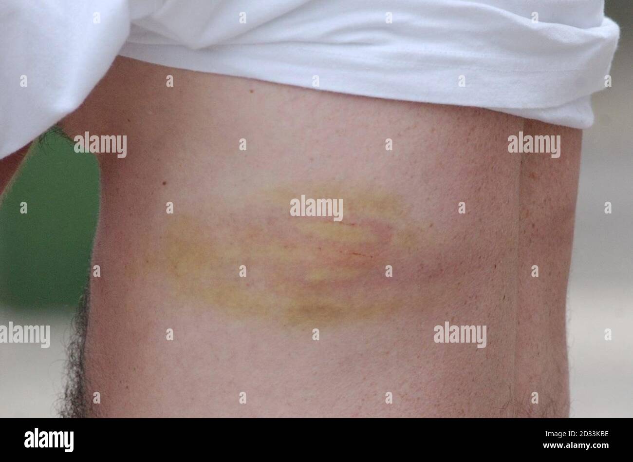 Peter Barwick, 37, in Teesside, where he was showing injuries he ...