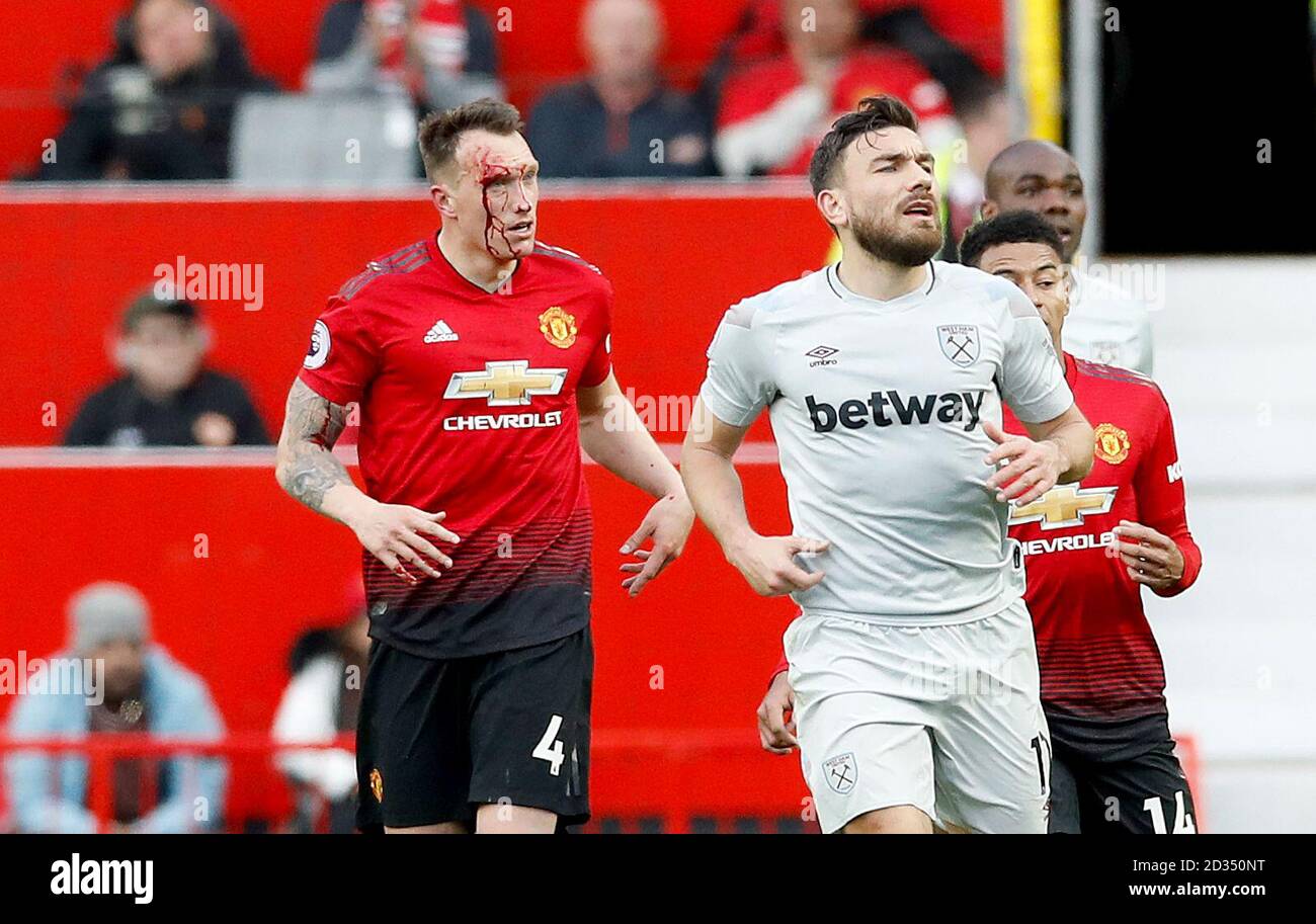 Manchester United's Phil Jones with a facial injury during the Premier ...