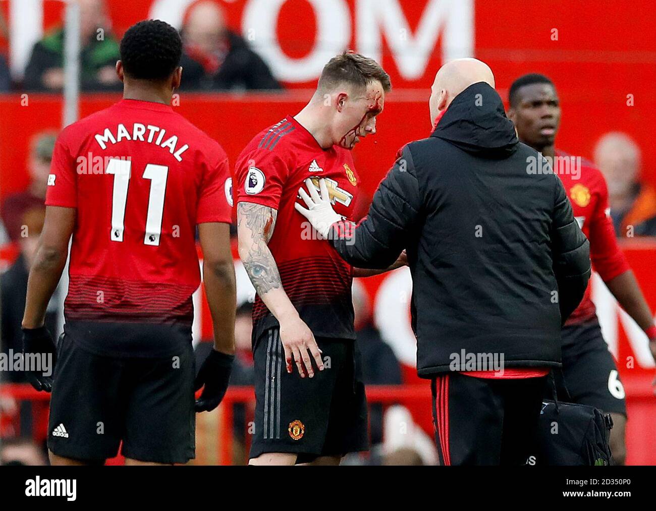 Manchester United's Phil Jones with a facial injury during the Premier ...