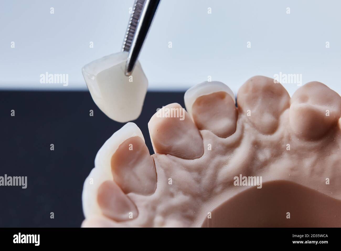 Human teeth row hi-res stock photography and images - Alamy