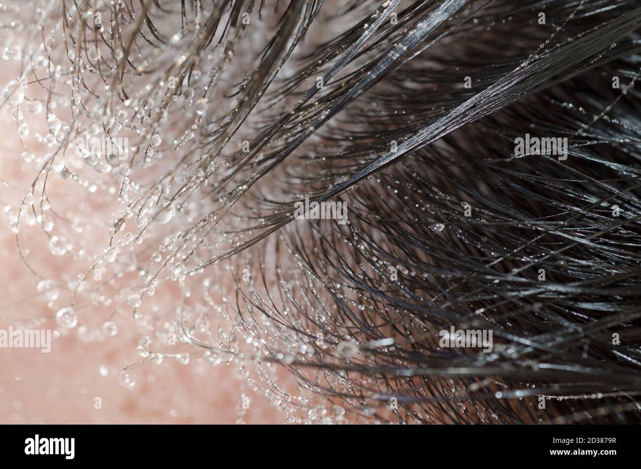 Water vesicles hi-res stock photography and images - Alamy