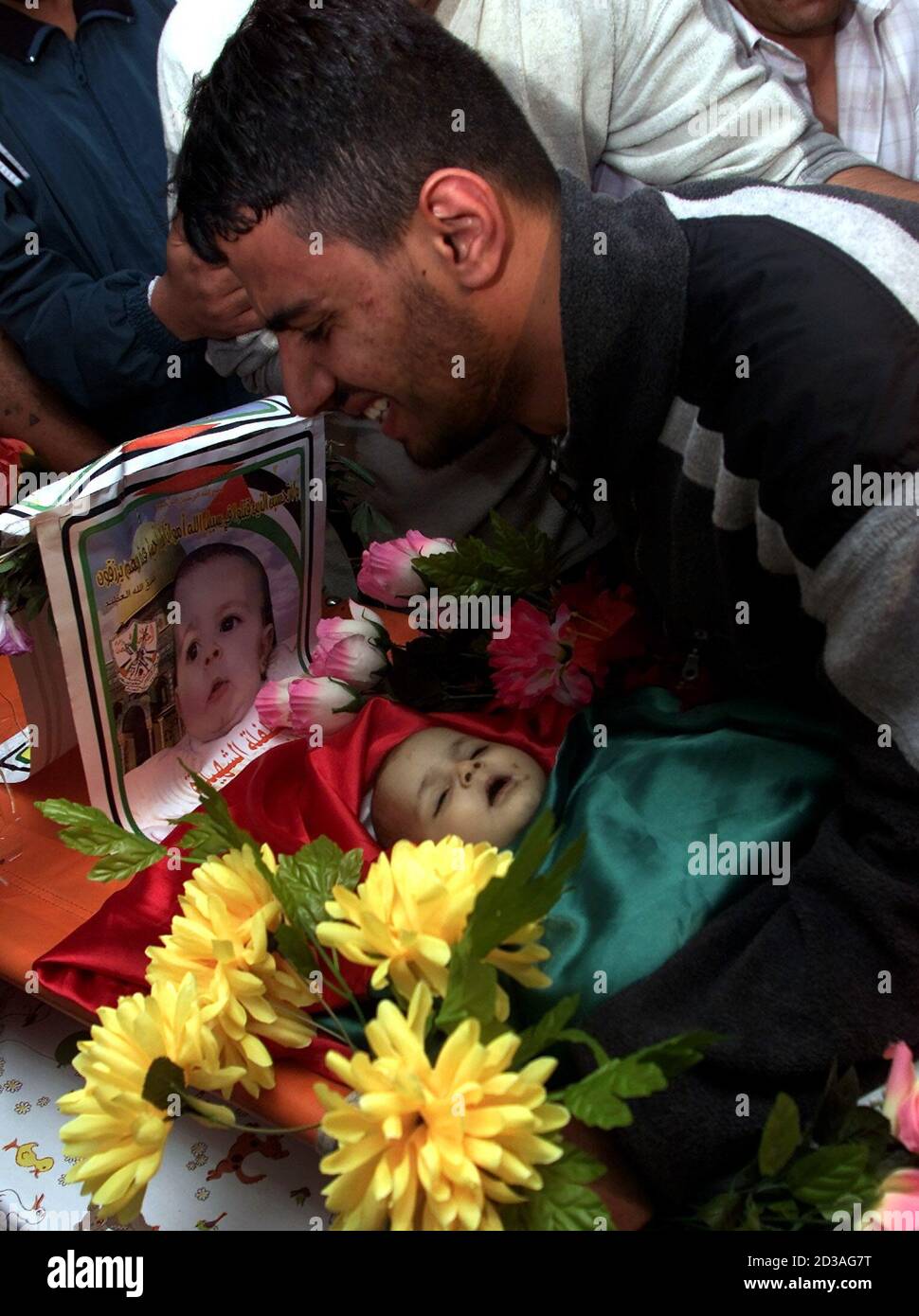 Shrapnel victim hi-res stock photography and images - Alamy