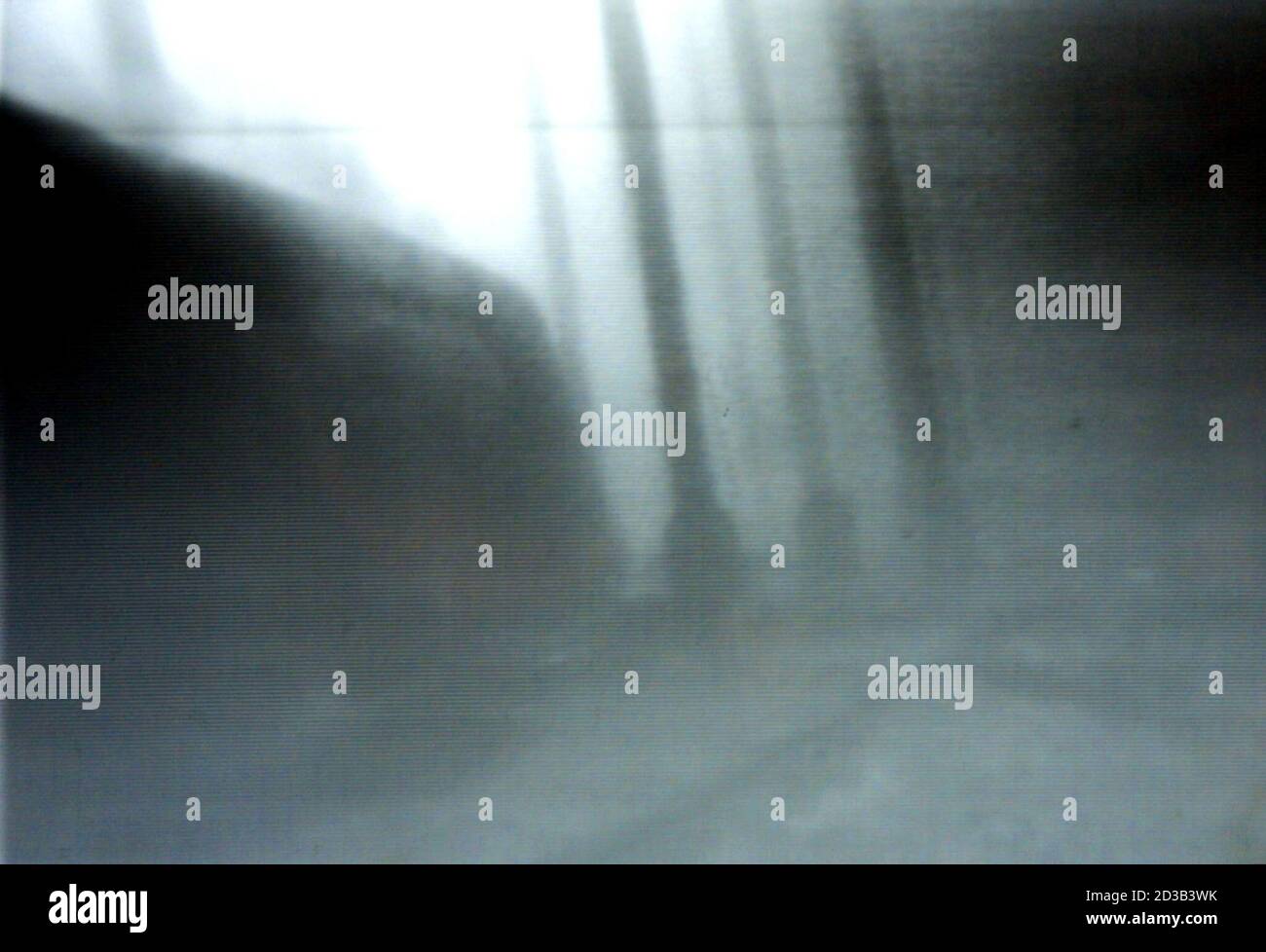 Raised floor russia hi-res stock photography and images - Alamy