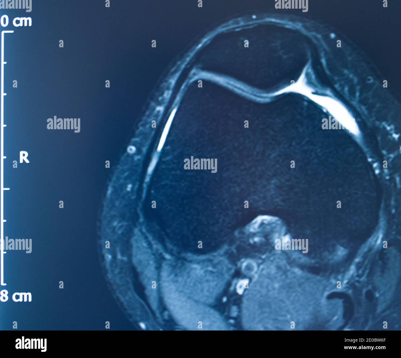 Sports Injury Clinic Mri at Angela Williamson blog