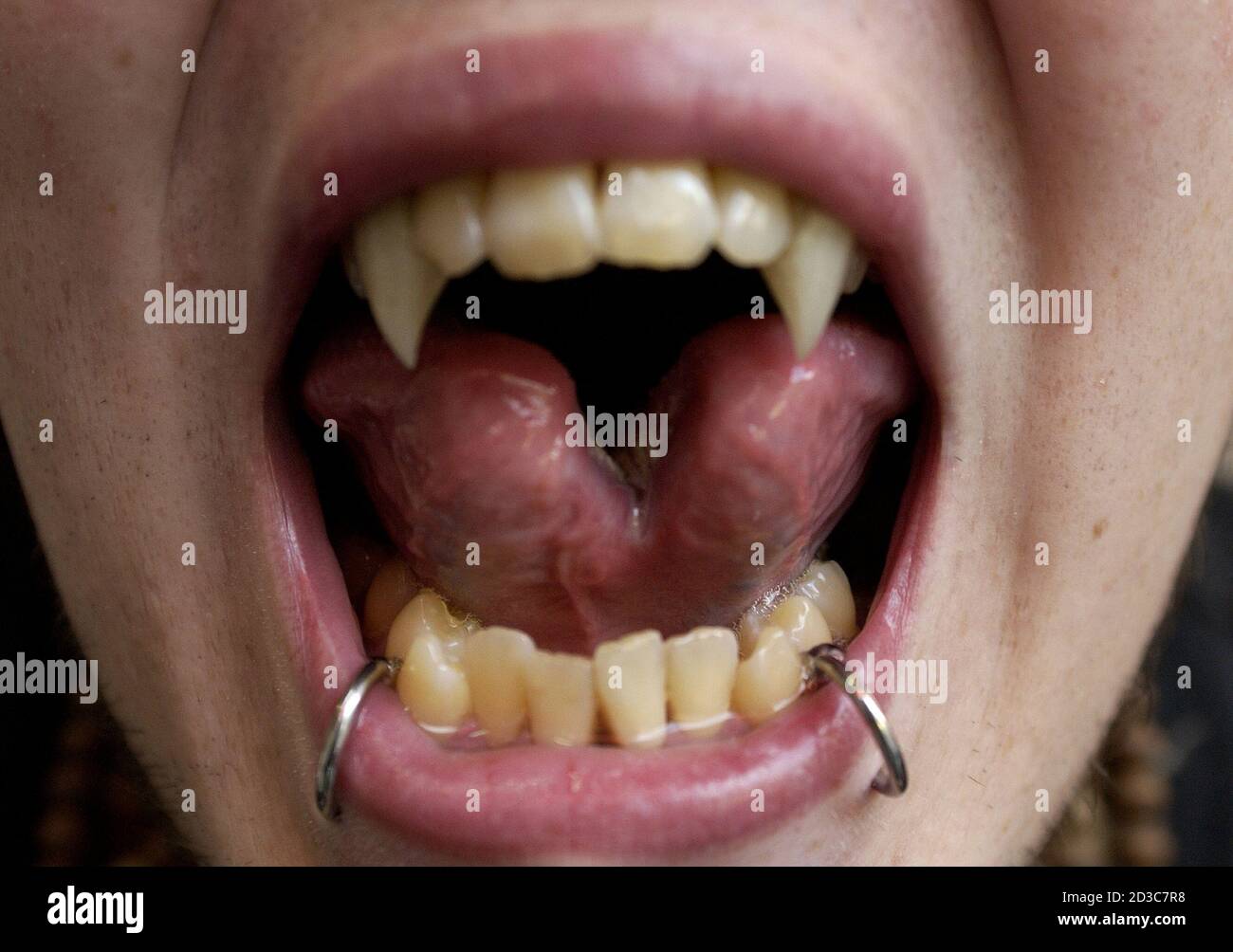 Sharpened Teeth Body Modification