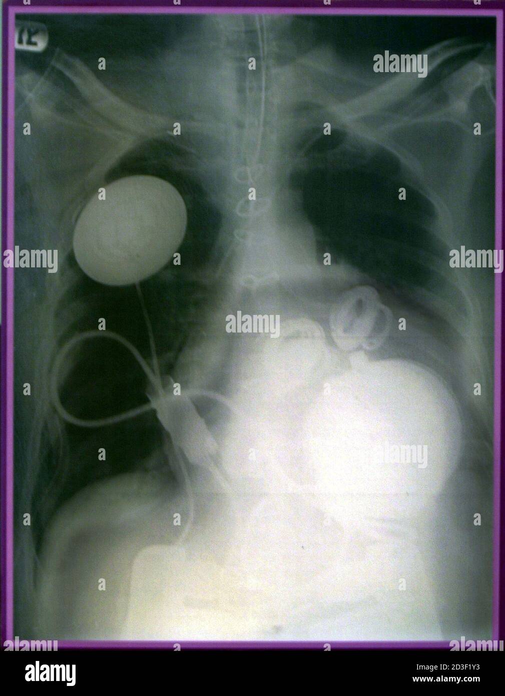 The man with the worlds first mechanical hi-res stock photography and ...