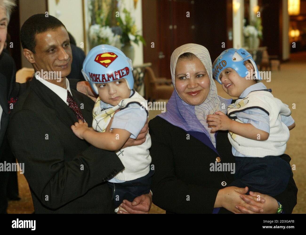 Conjoined twins separated hi-res stock photography and images - Alamy