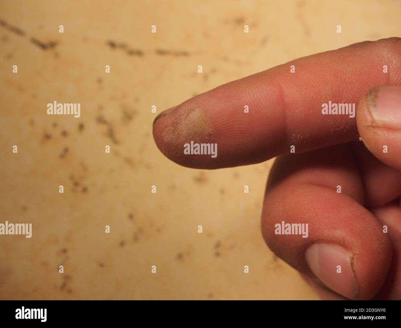 Burn marks hi-res stock photography and images - Alamy
