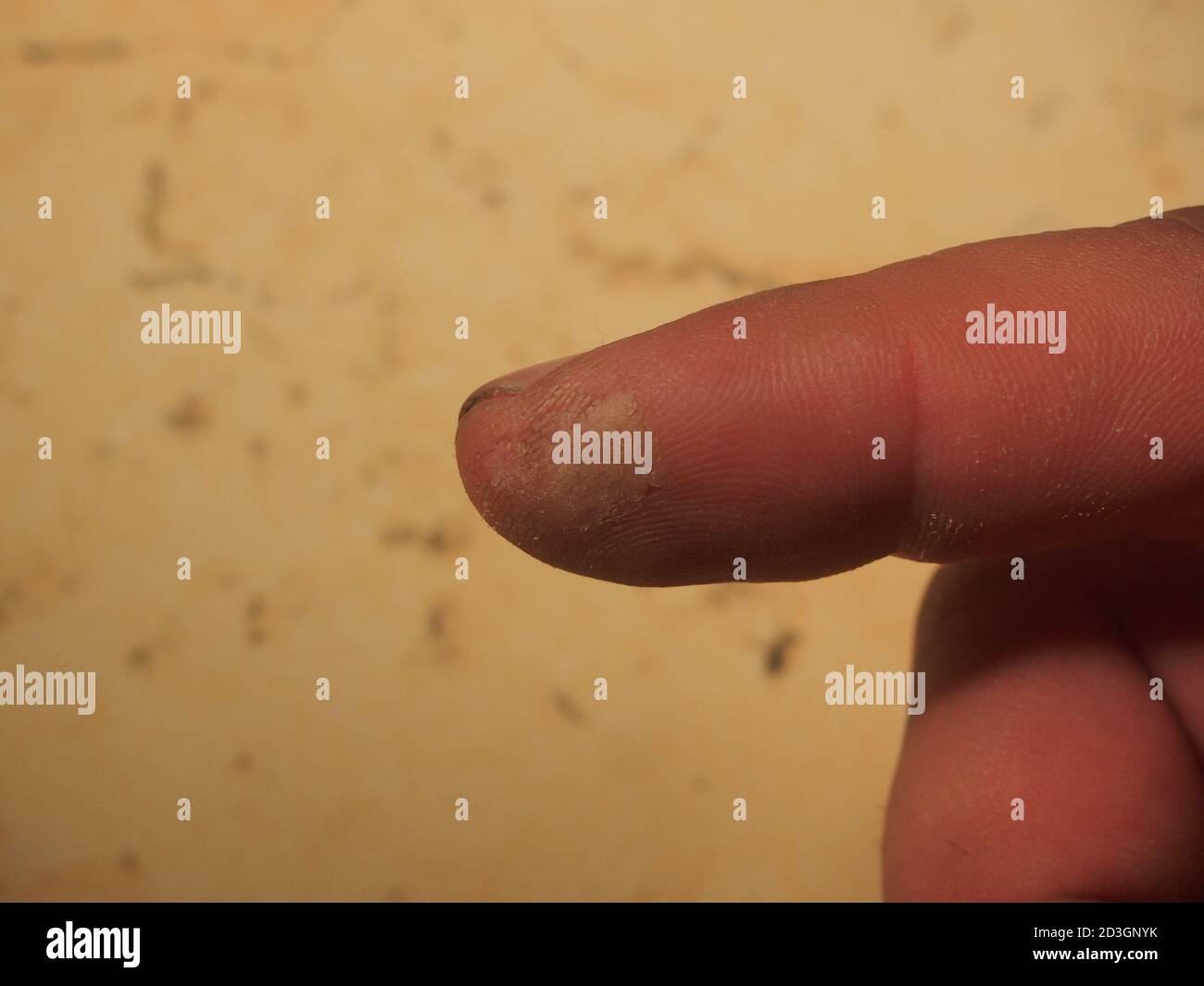 Burn marks hi-res stock photography and images - Alamy