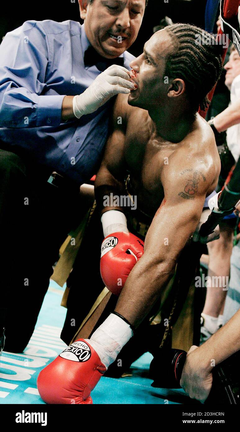 Boxing mouthguard hi-res stock photography and images - Alamy