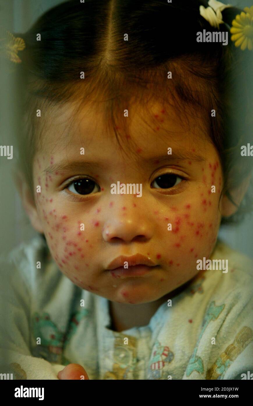 Decomposing corpse hi-res stock photography and images - Alamy