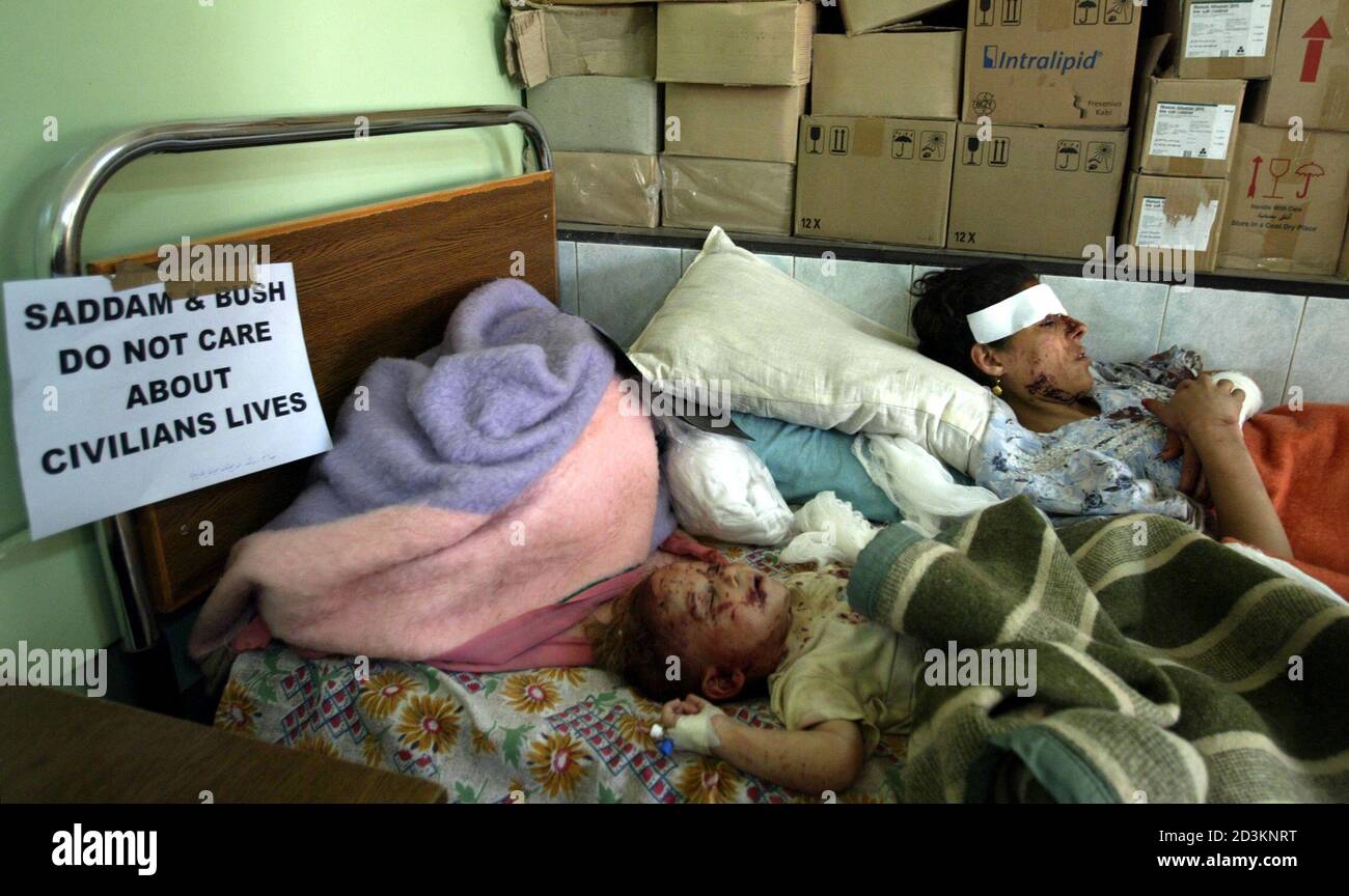 Injured arms explosion hi-res stock photography and images - Alamy