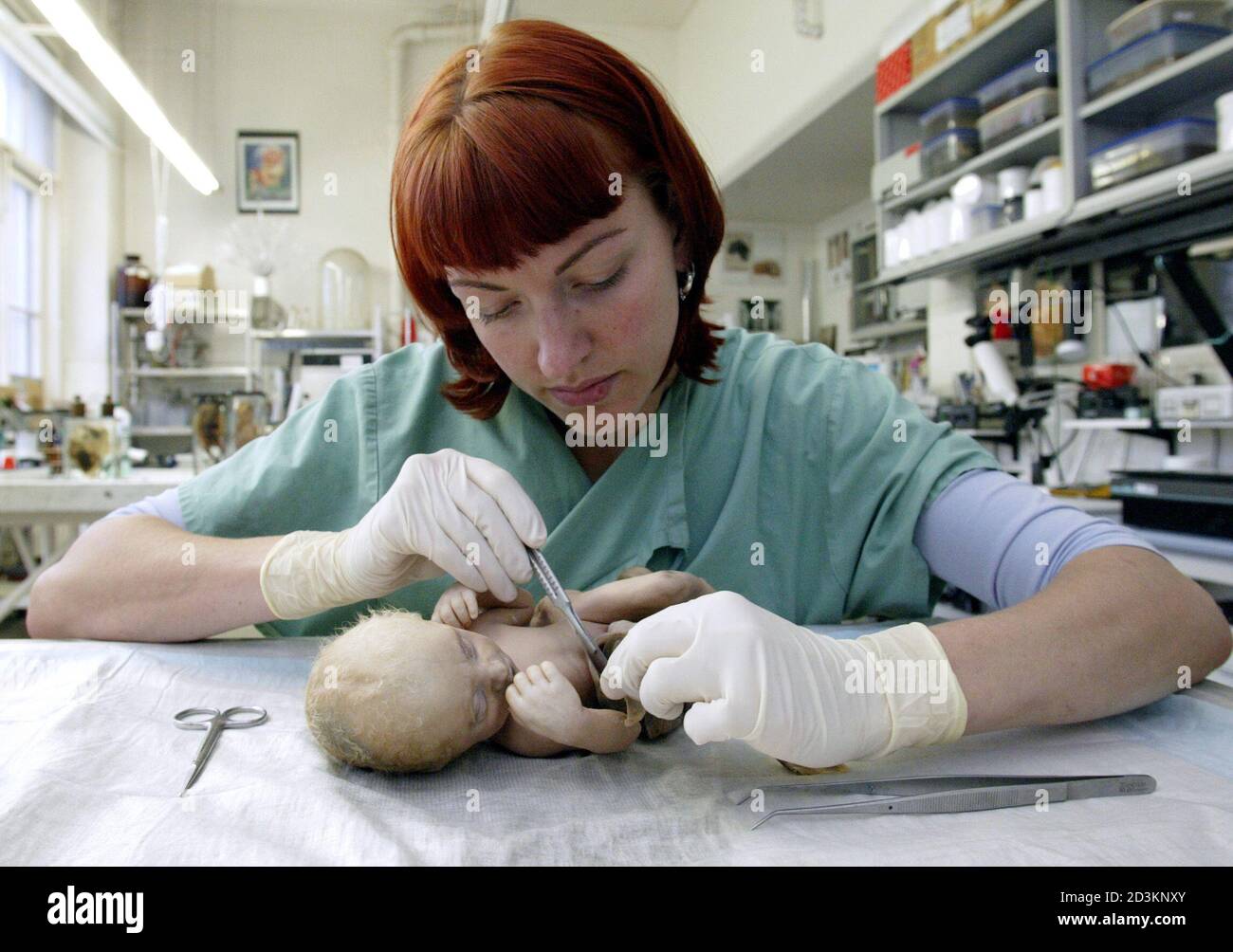 Pathological anatomical museum hi-res stock photography and images - Alamy