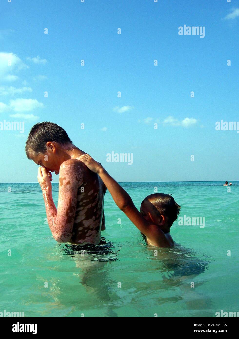 Chernobyl disaster 1986 hospital hi-res stock photography and images ...