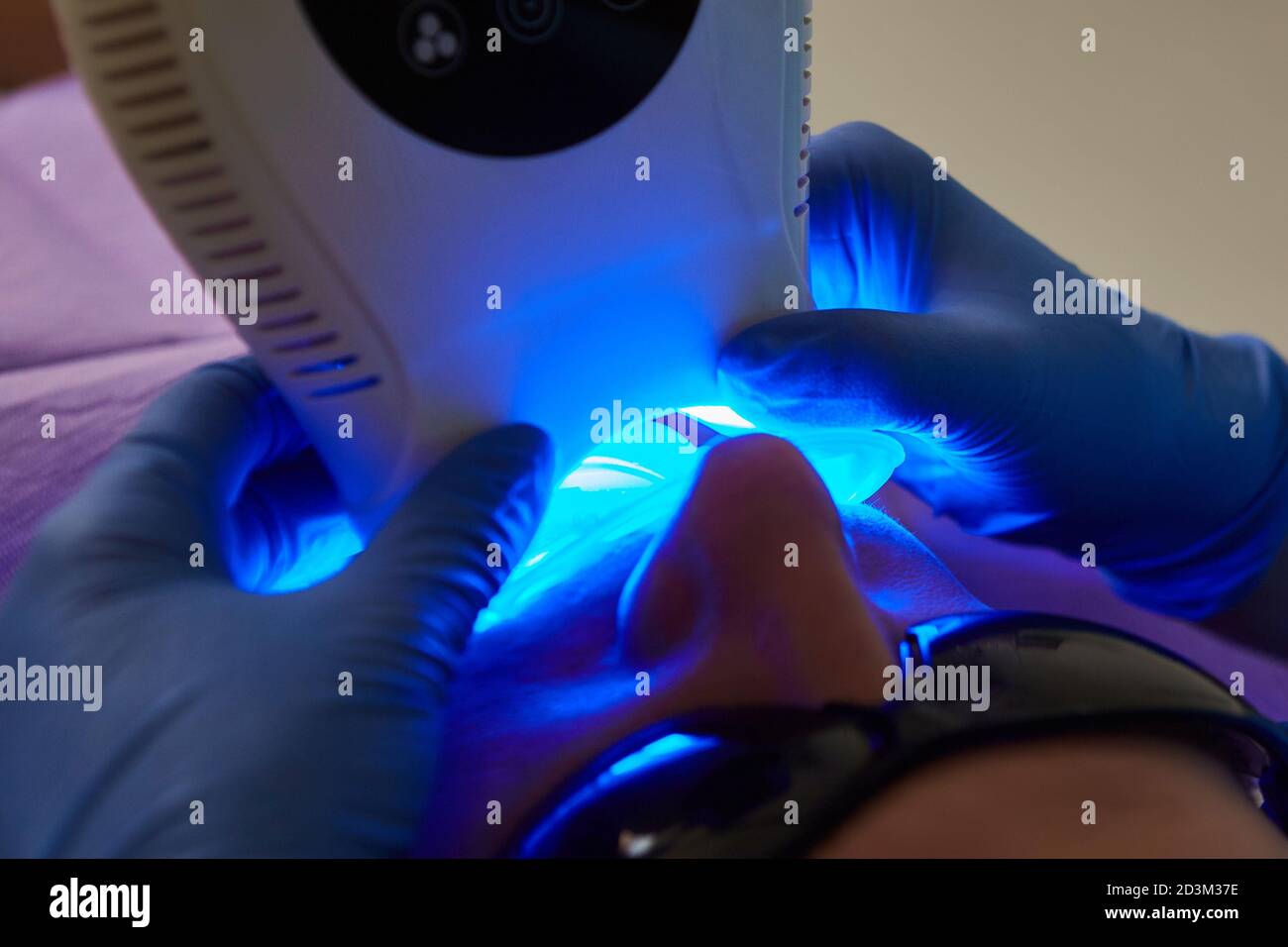 Close-up portrait of a female patient at dentist in the clinic. Tooth ...