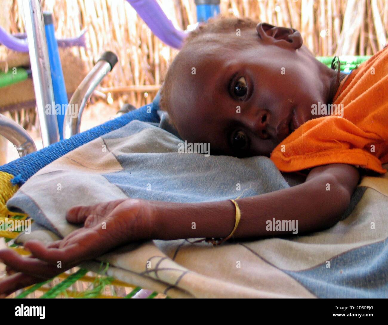 Malnourished children south sudan hi-res stock photography and images ...