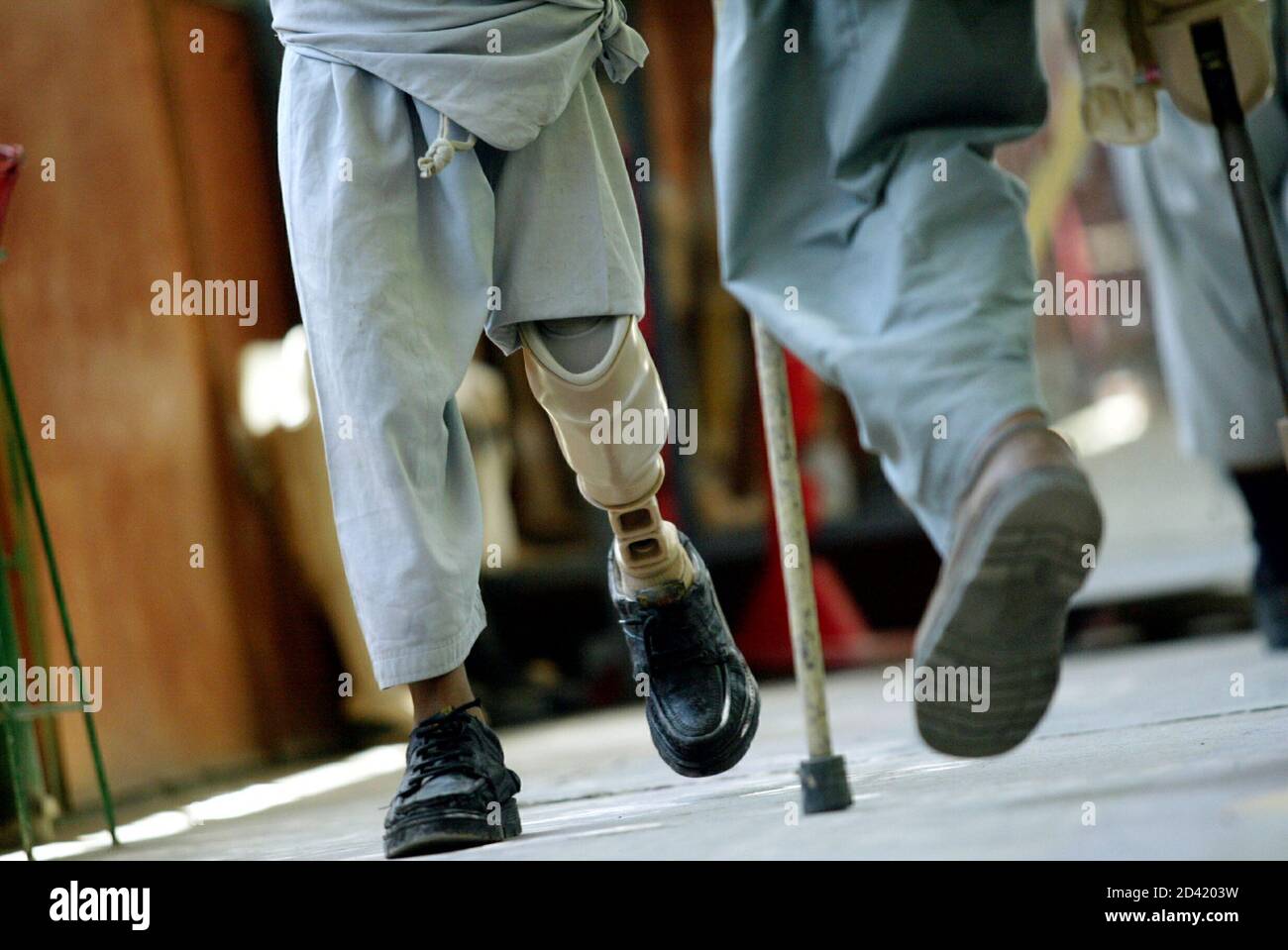 Who lost a leg in a landmine explosion in afghanistan hi-res stock ...