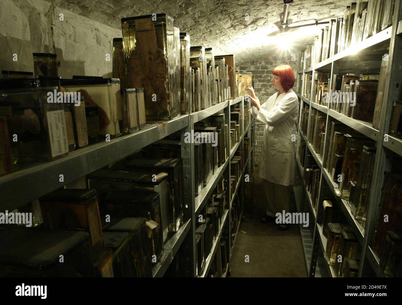 Pathological anatomical museum hi-res stock photography and images - Alamy