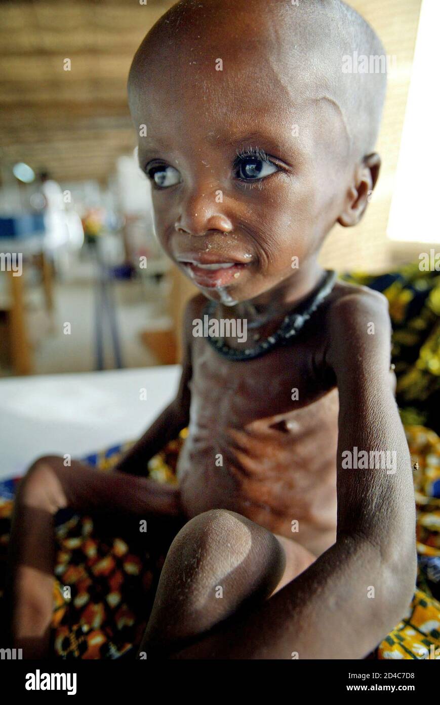 Medical neglect child hi-res stock photography and images - Alamy