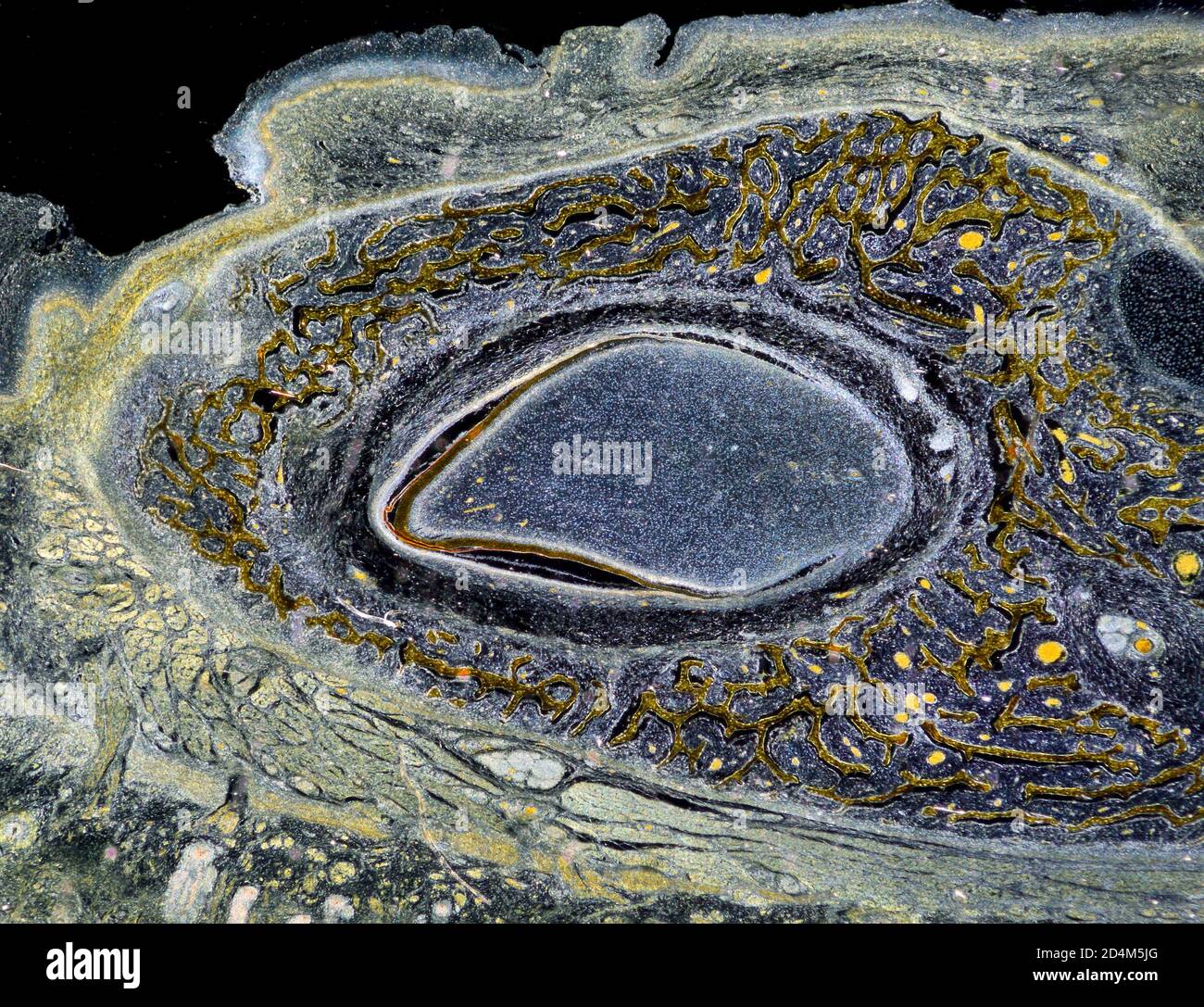 Developing mammal tooth in gum, section, darkfield photomicrograph ...