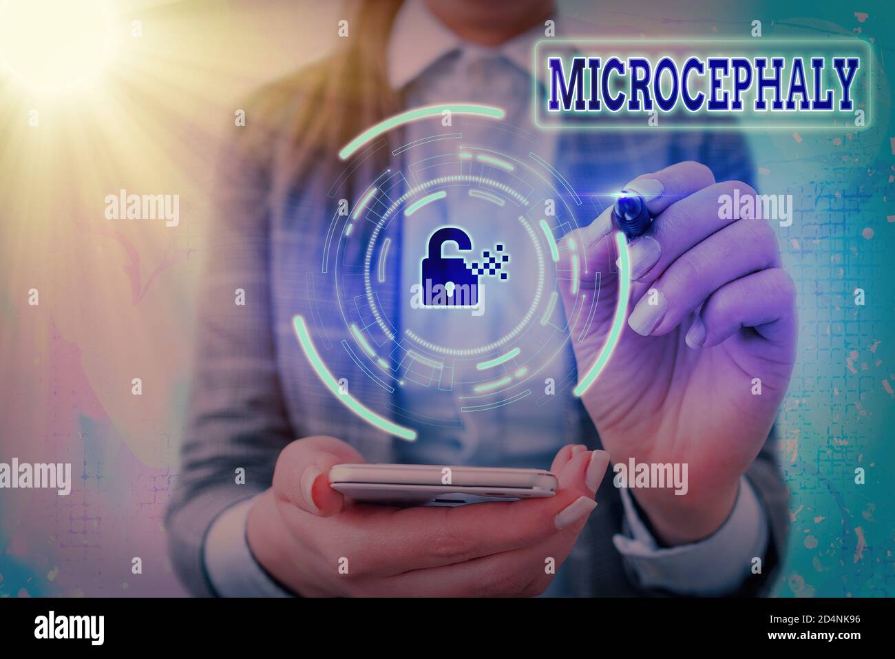 Conceptual hand writing showing Microcephaly. Concept meaning condition ...