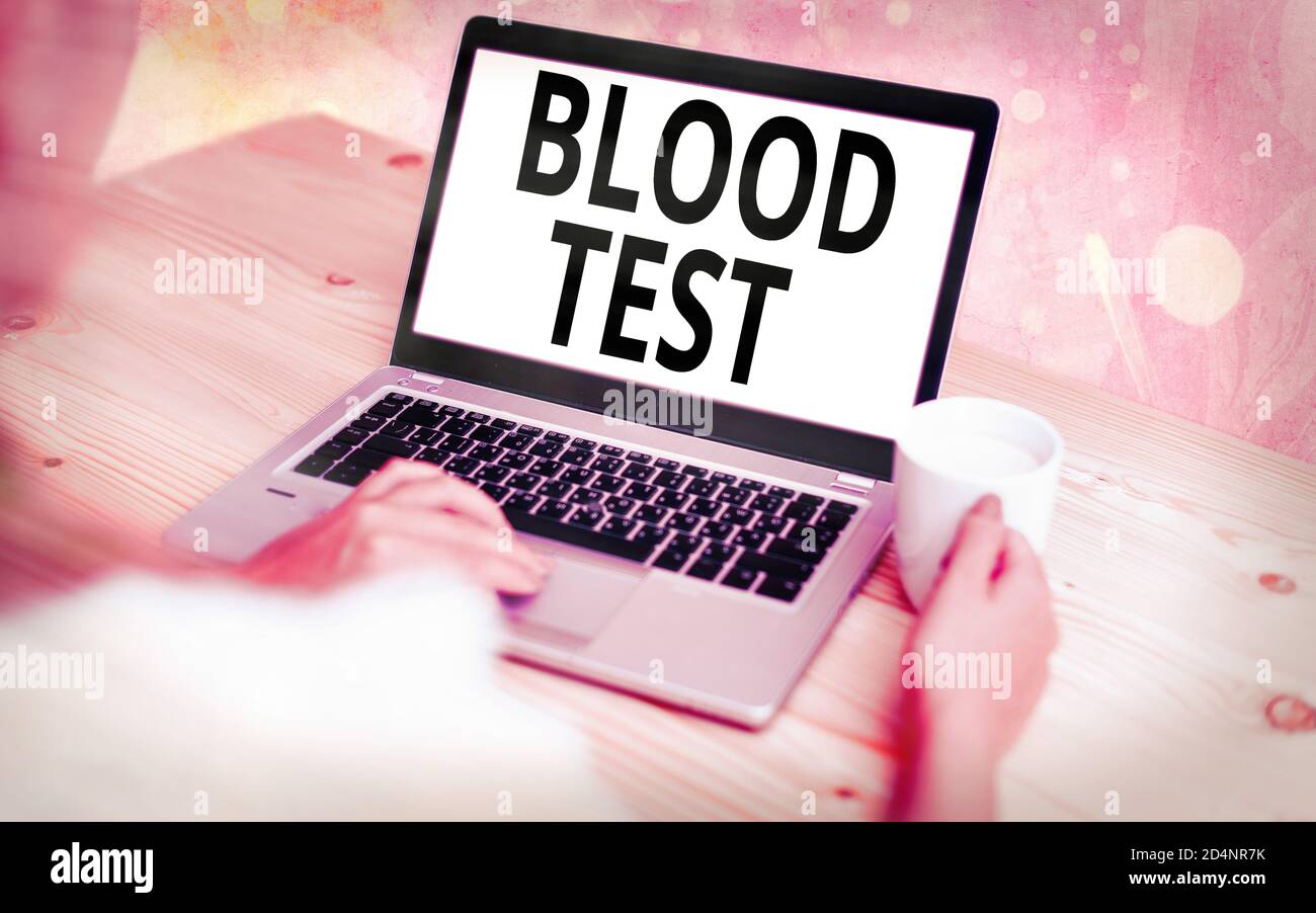 Text sign showing Blood Test. Business photo showcasing Extracted blood ...