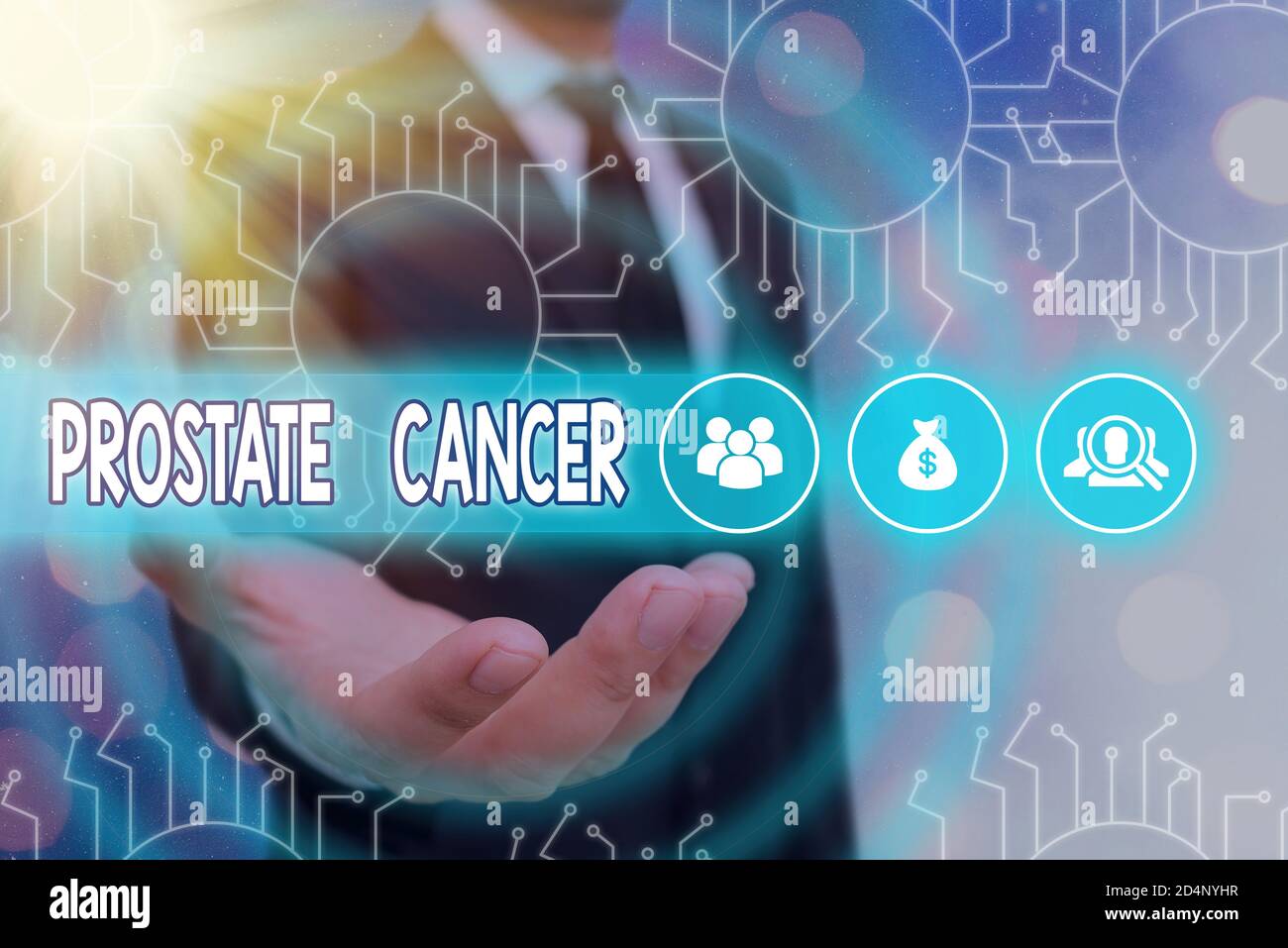 Conceptual hand writing showing Prostate Cancer. Concept meaning ...