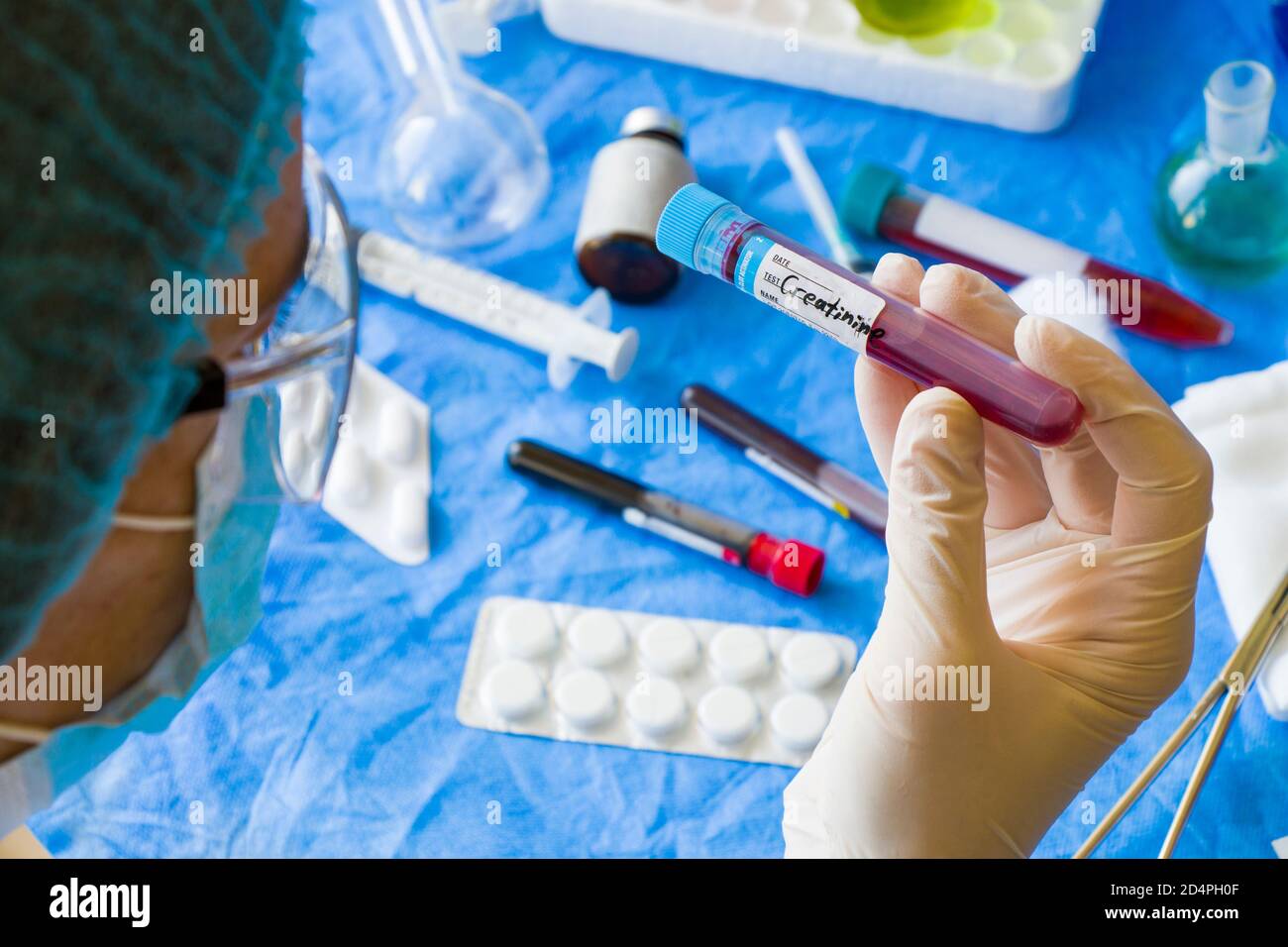 Creatinine blood test tube sample in doctors hand in laboratory ...