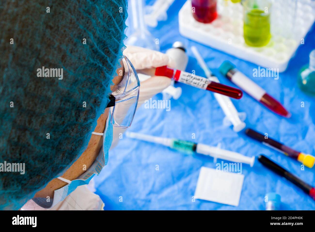 Hepatic blood test tube sample in doctors hand, doctors head with mask ...