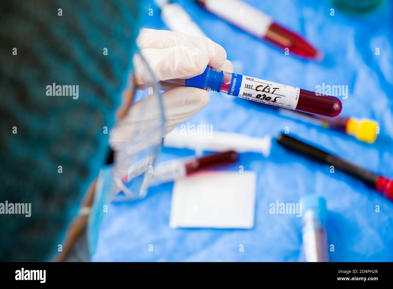 CBC 0305 blood test tube sample in doctors hand Stock Photo - Alamy
