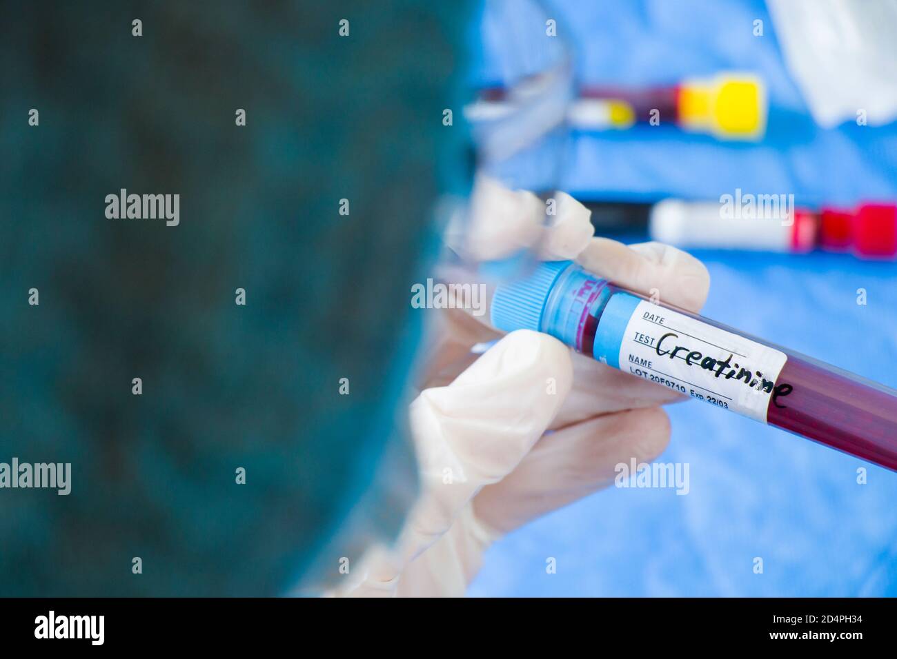 Creatinine blood test tube sample in doctors hand in laboratory ...