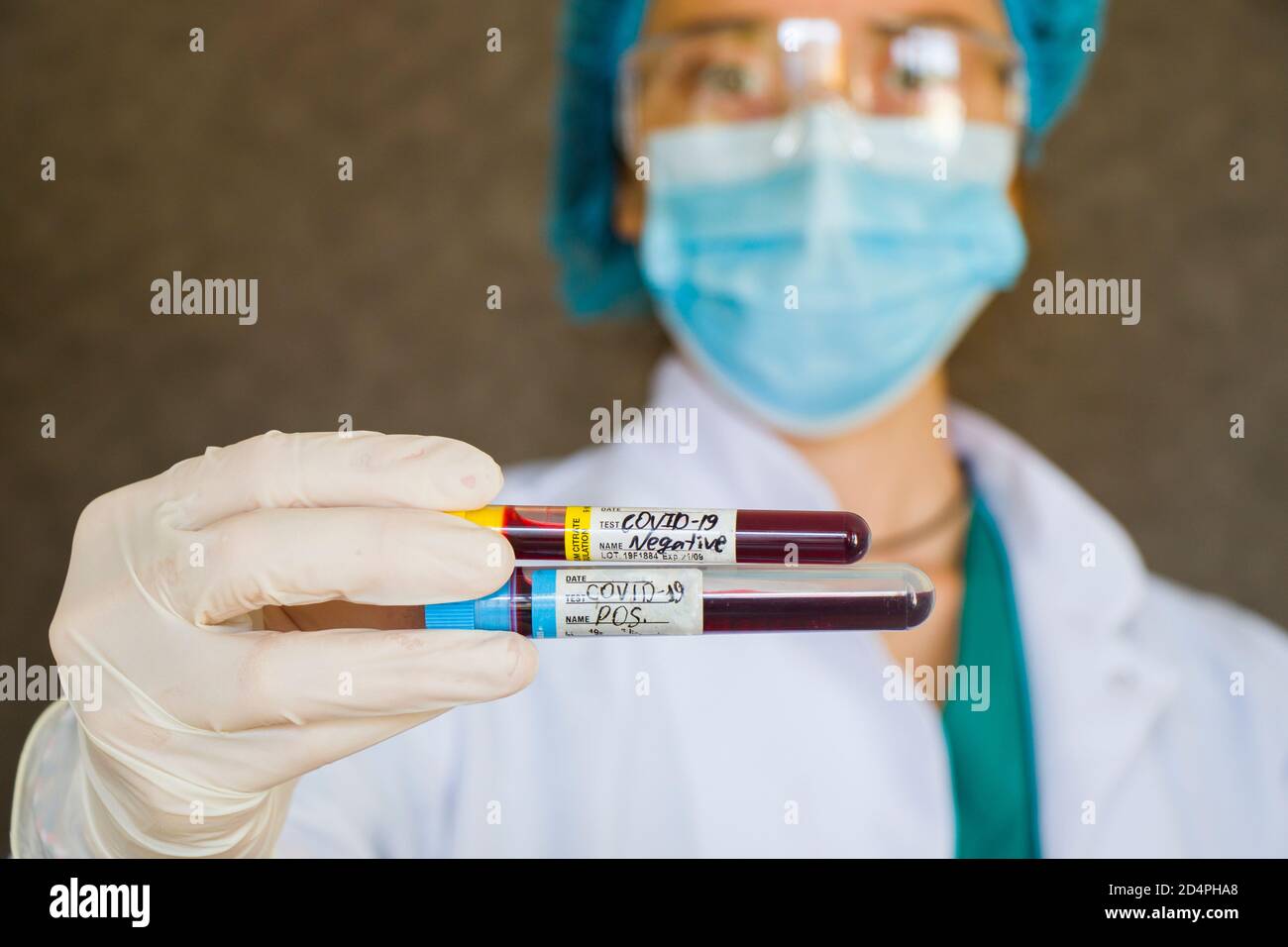 Corona virus negative and negative test samples. Doctors head and hand ...