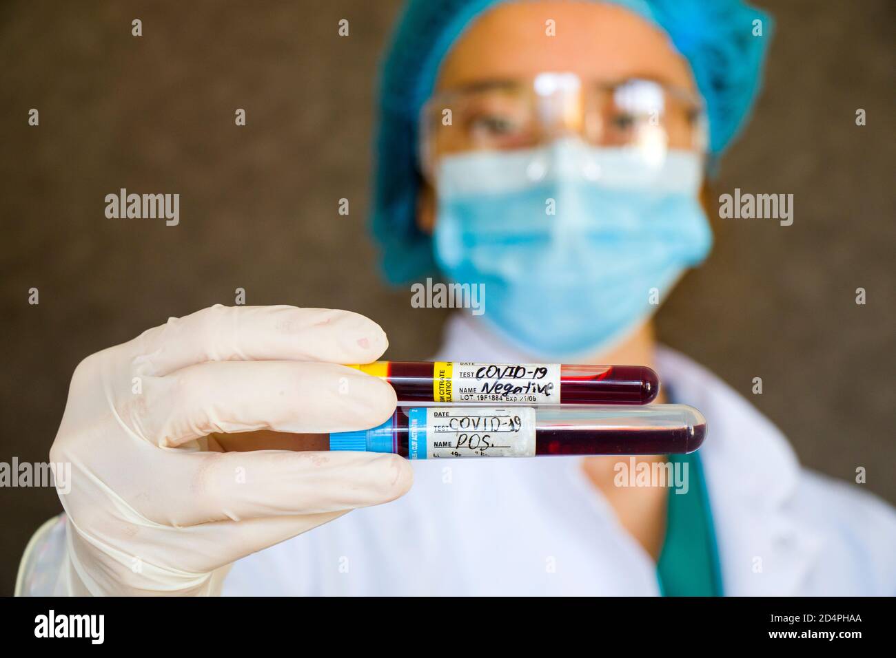 Corona virus negative and negative test samples. Doctors head and hand ...
