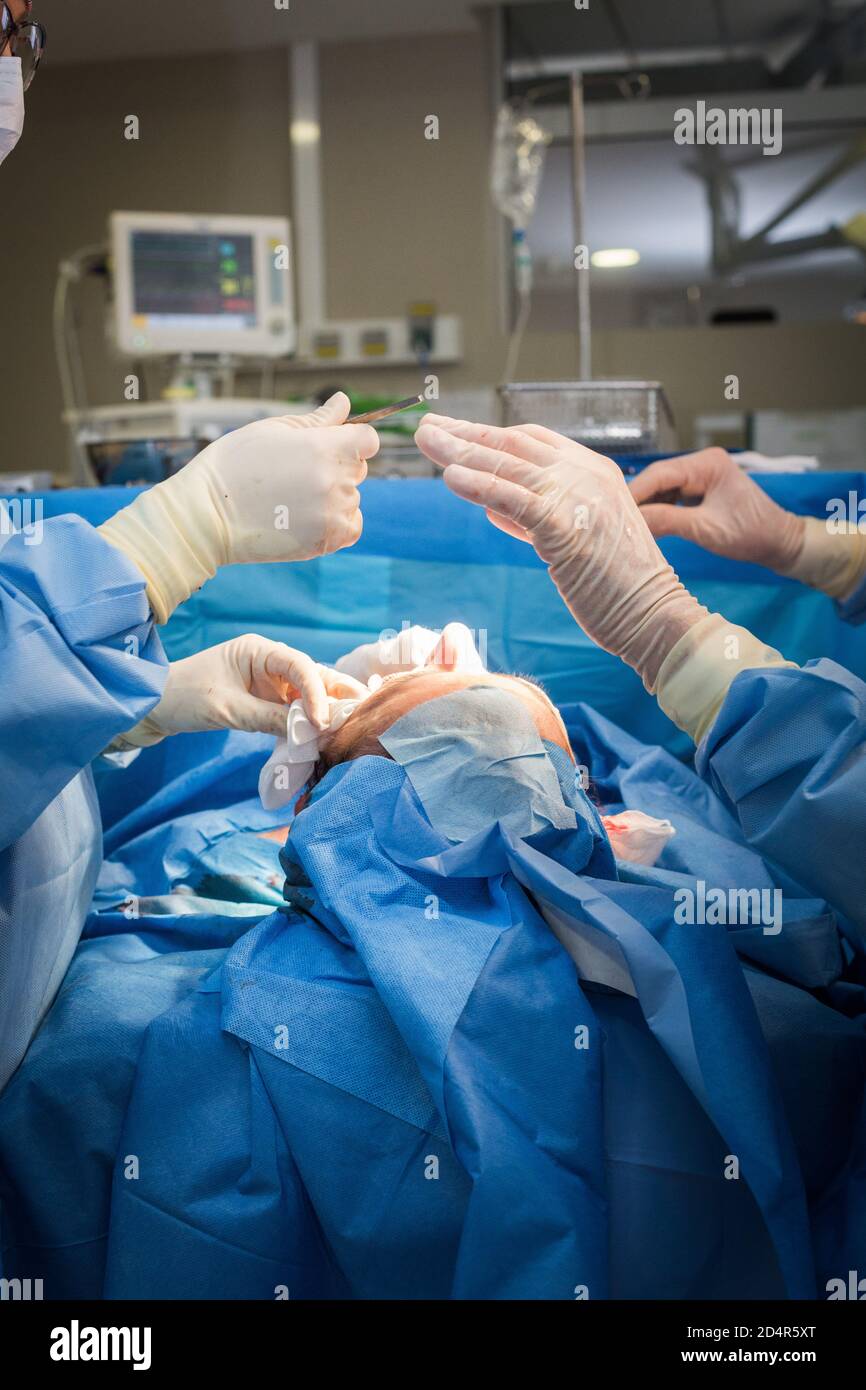 Blepharoplasty, surgery to remove the bags from under his eyes, France ...