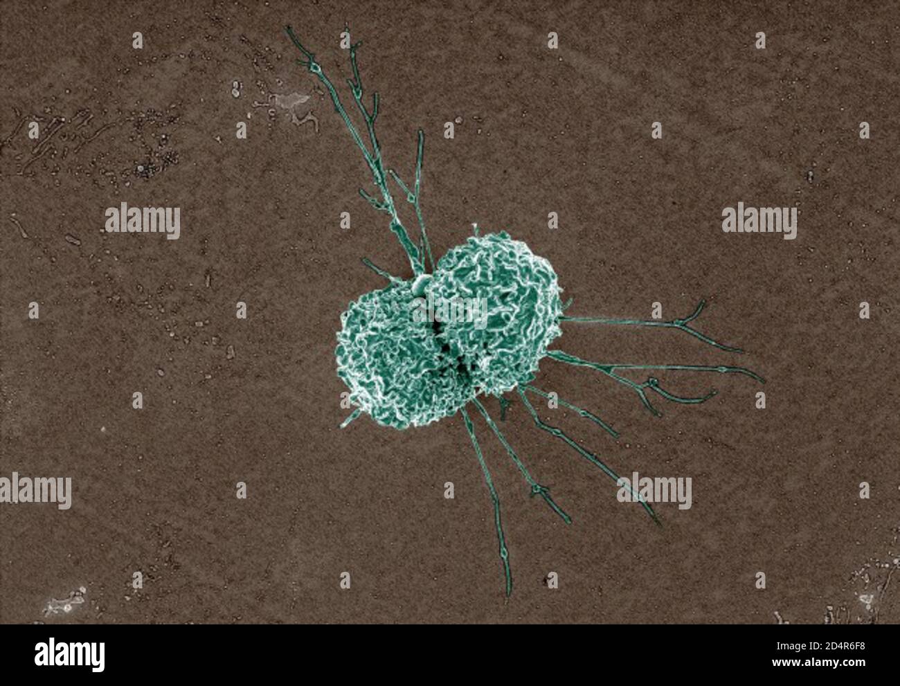 Macrophage Colorized scanning electron micrograph of a macrophage ...