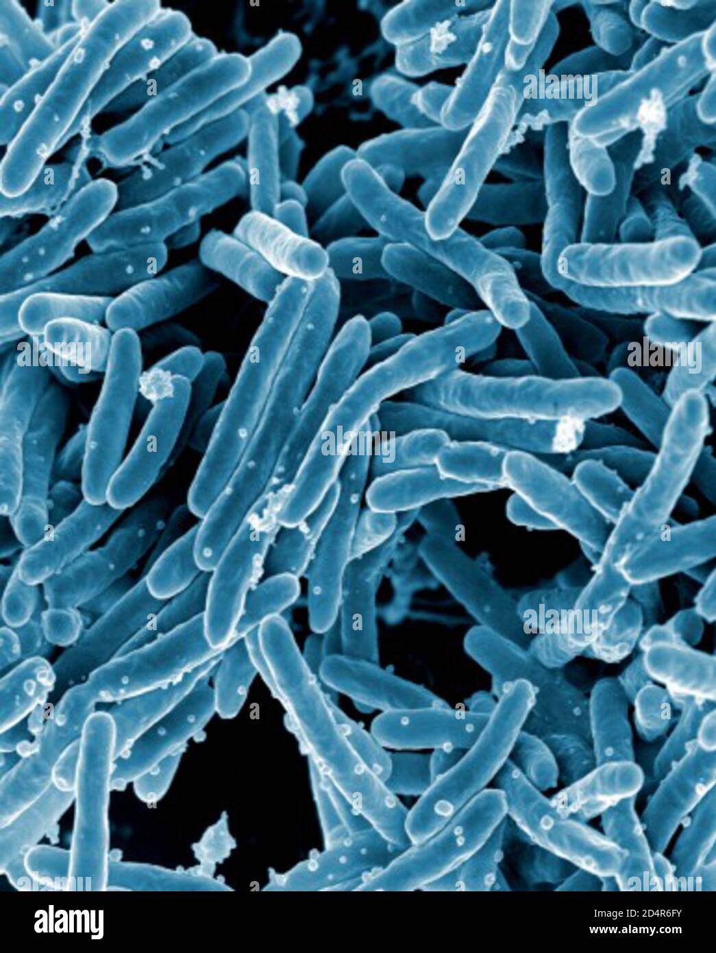 Mycobacterium tuberculosis Bacteria Scanning electron micrograph of Mycobacterium tuberculosis ...