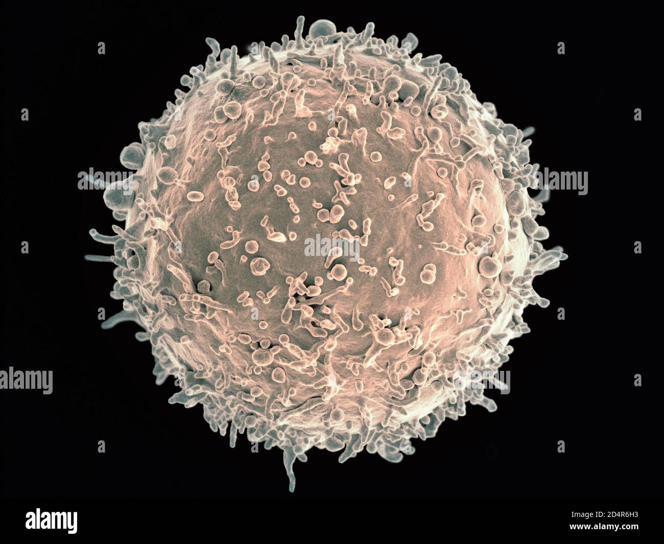 Human B Lymphocyte Colorized scanning electron micrograph of a B cell ...