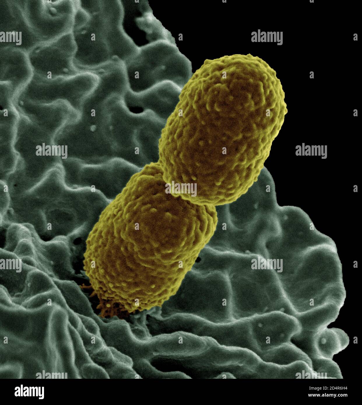 Klebsiella pneumoniae Bacterium Colorized scanning electron micrograph ...