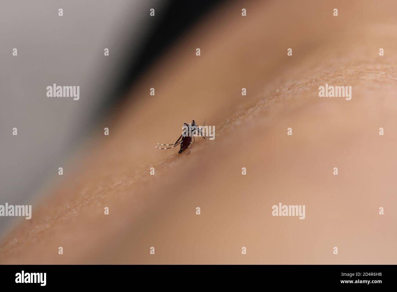 Aedes Mosquito Bite by an Aedes mosquito. This species can transmit ...