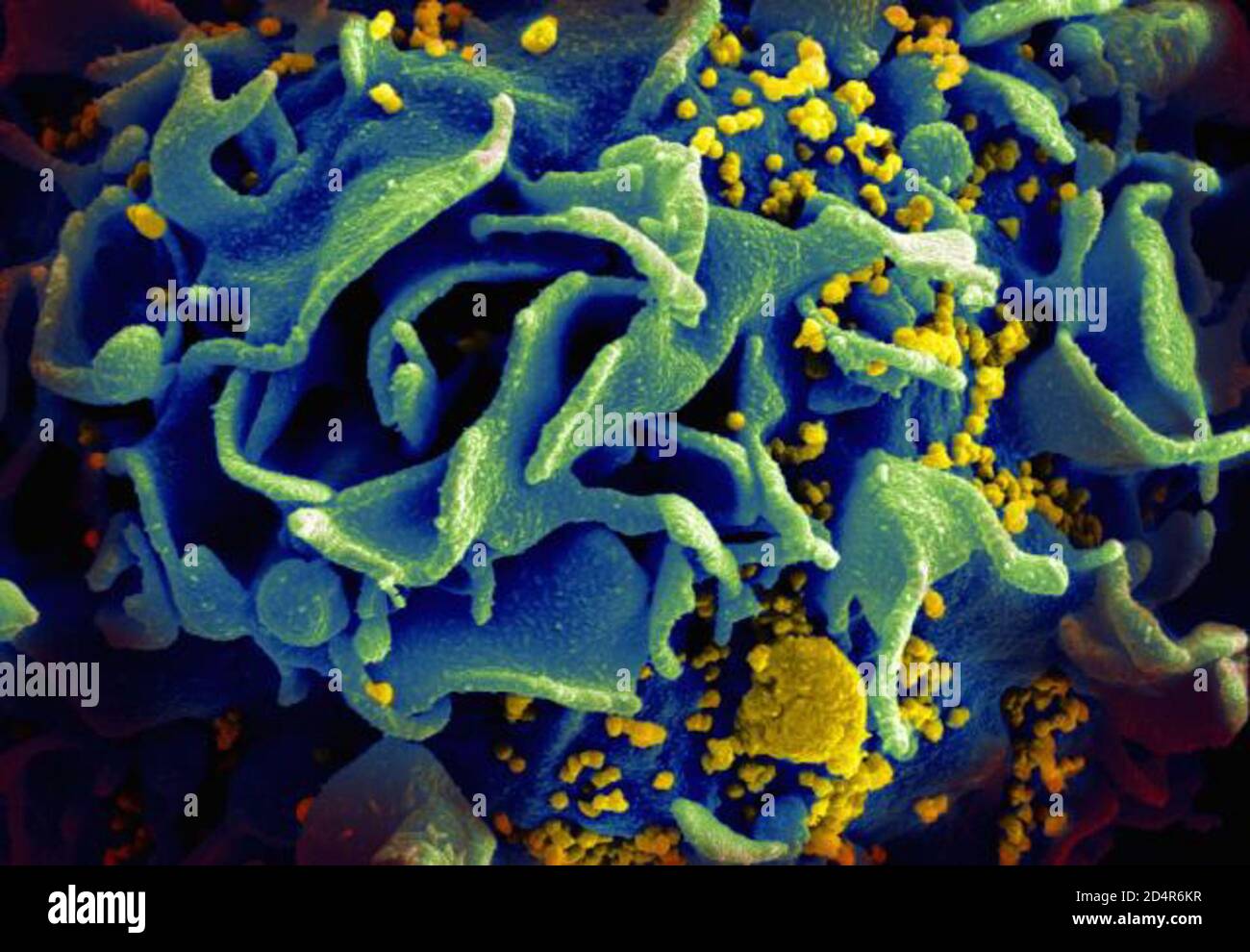HIV-infected T cell Scanning electromicrograph of an HIV-infected T ...