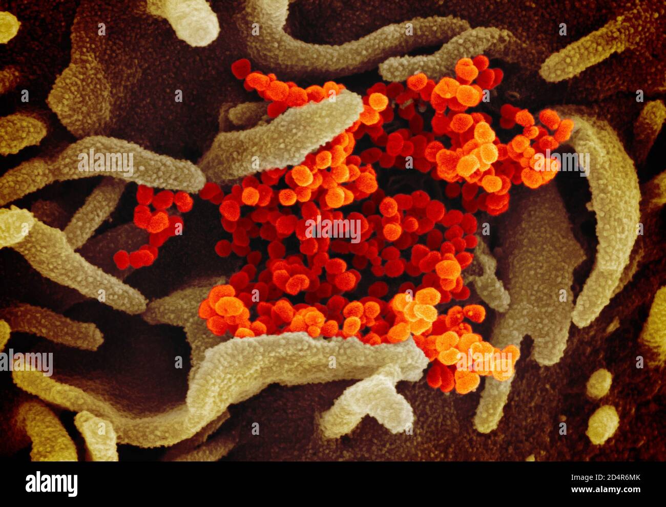 Novel Coronavirus SARS-CoV-2This scanning electron microscope image ...