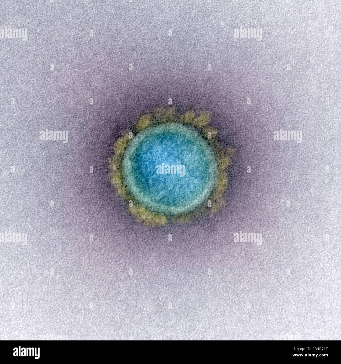 This transmission electron microscope image shows SARS-CoV-2—also known ...