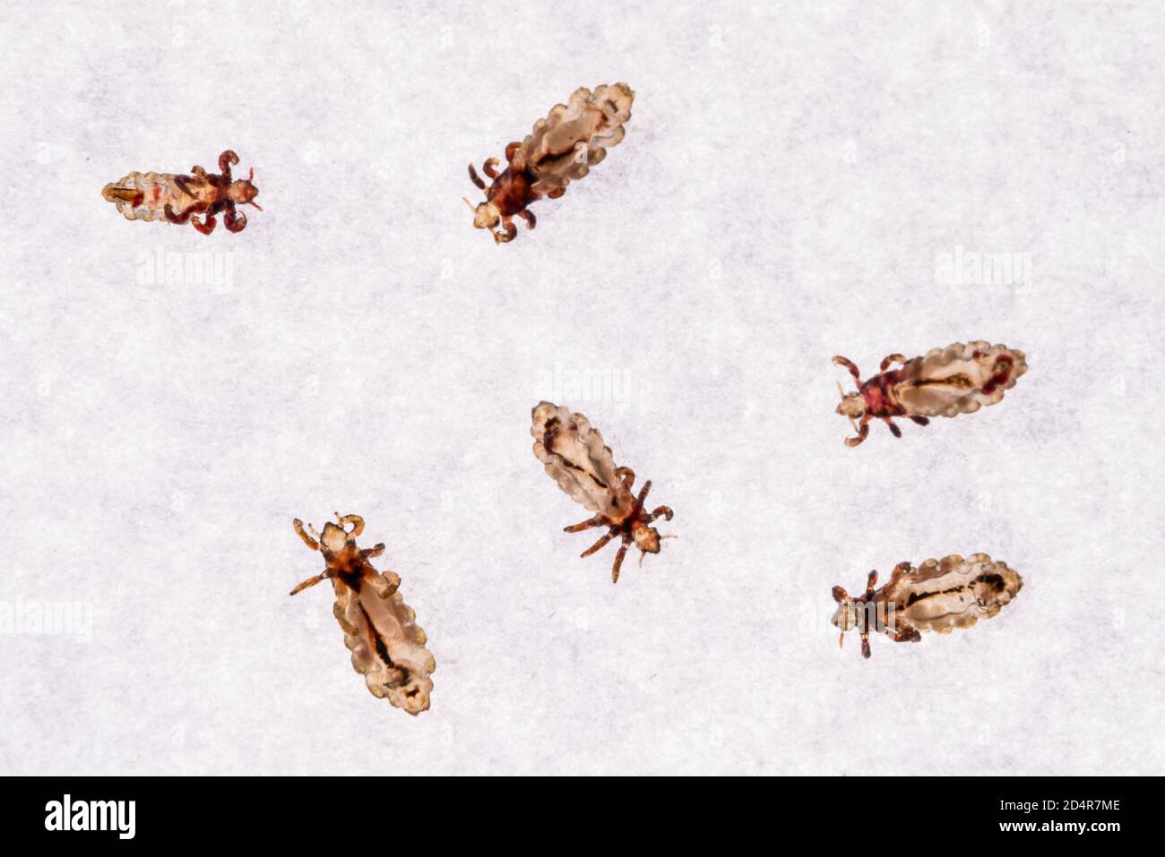 Head louse hi-res stock photography and images - Alamy