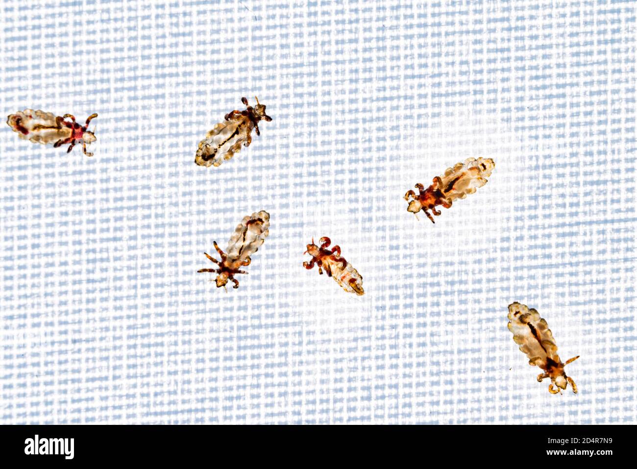 Head louse hi-res stock photography and images - Alamy