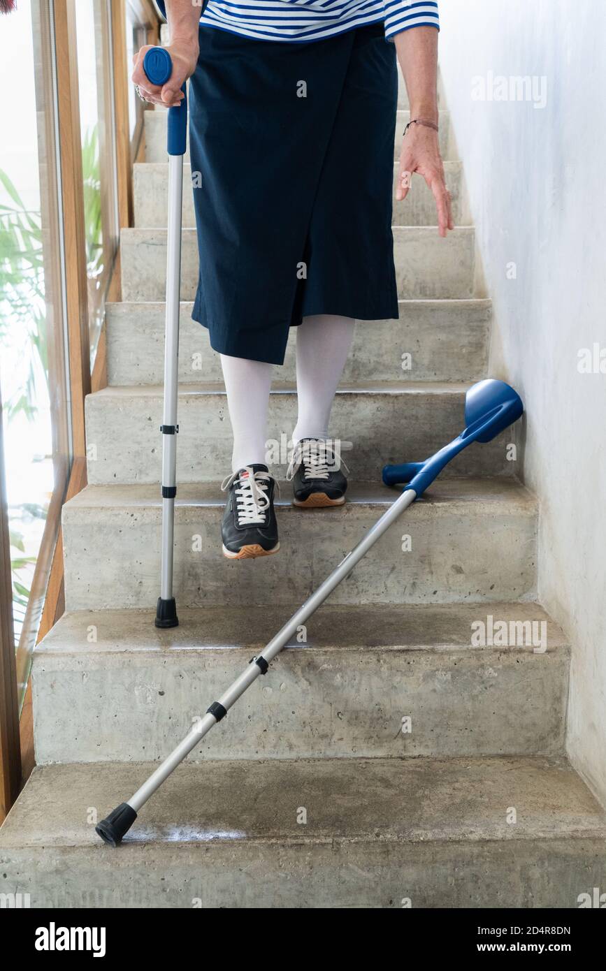 Woman walking with crutches Stock Photo - Alamy